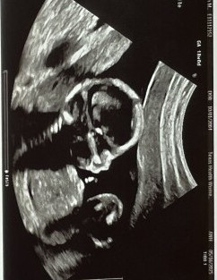 Kase Walker Maddox – The Flash Today Erath County